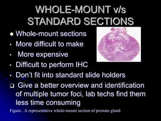 Handling of radical prostatectomy specimens | PPT