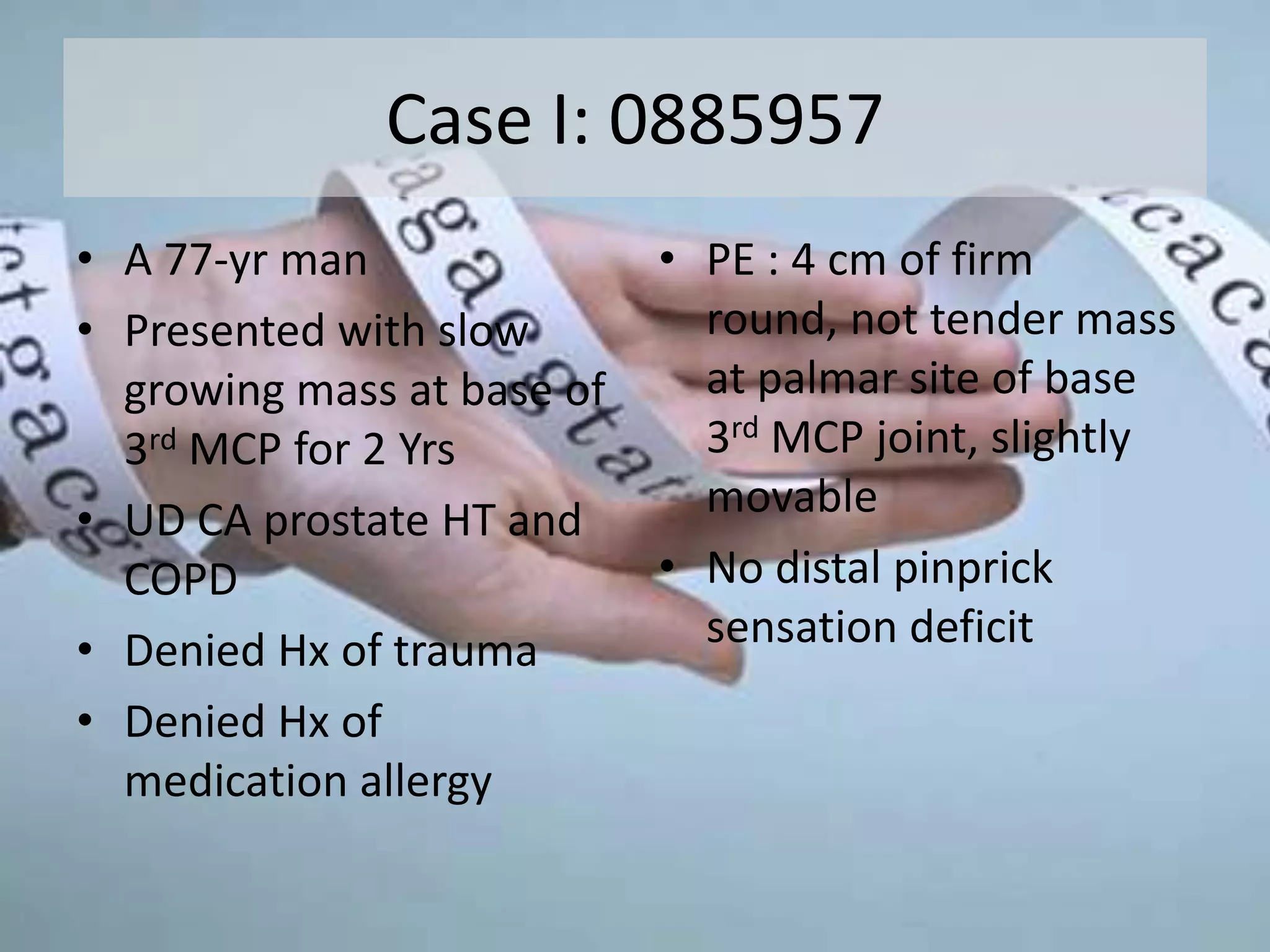 Hand mass: General basic | PPTX