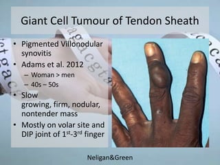 Hand mass: General basic | PPT