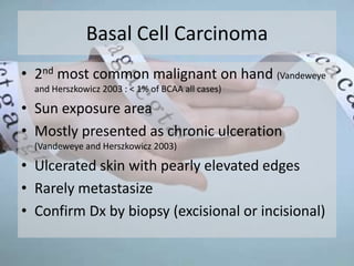 Hand mass: General basic | PPT