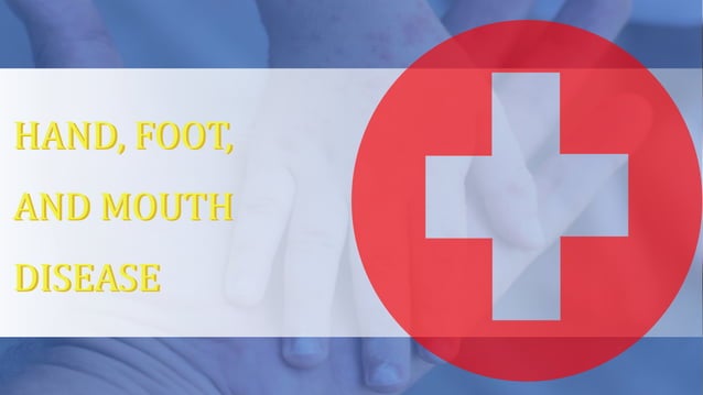 Hand Mouth Foot Disease.pptx