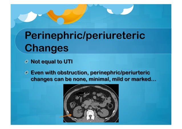 Stone protocol CT: Why, How and Pitfalls | PPT | Free Download
