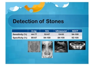 Stone protocol CT: Why, How and Pitfalls | PPT