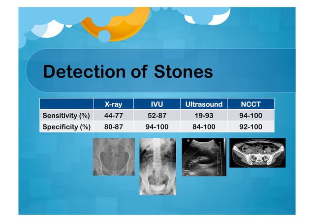 Stone protocol CT: Why, How and Pitfalls | PPT | Free Download