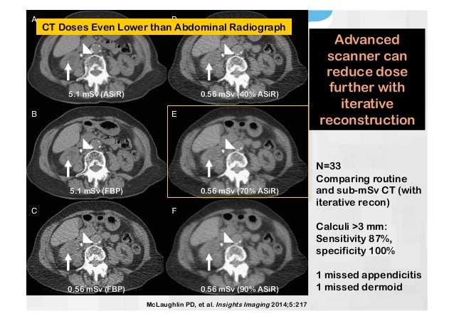 Stone protocol CT: Why, How and Pitfalls