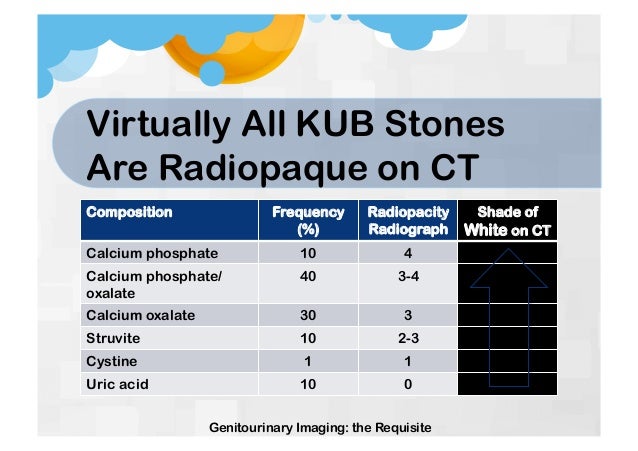 Stone protocol CT: Why, How and Pitfalls