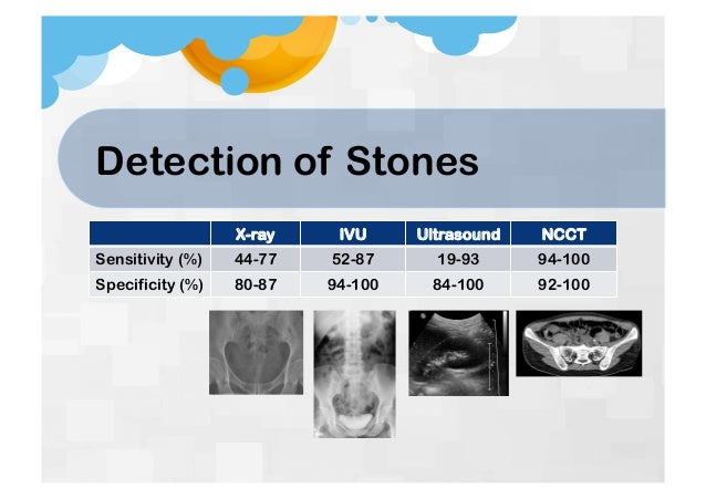 Stone protocol CT: Why, How and Pitfalls