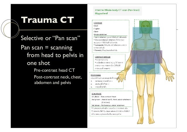Emergency CT: Updates
