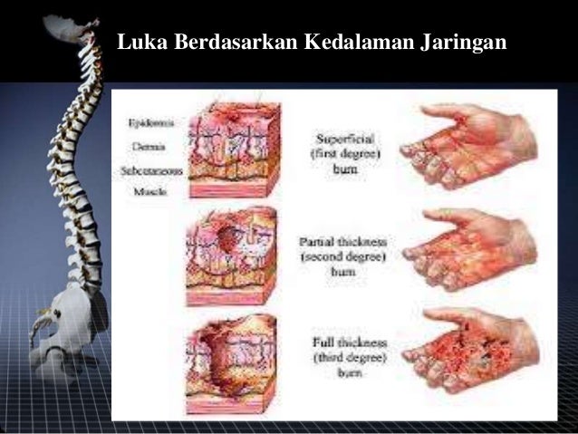 Perawatan Luka Operasi