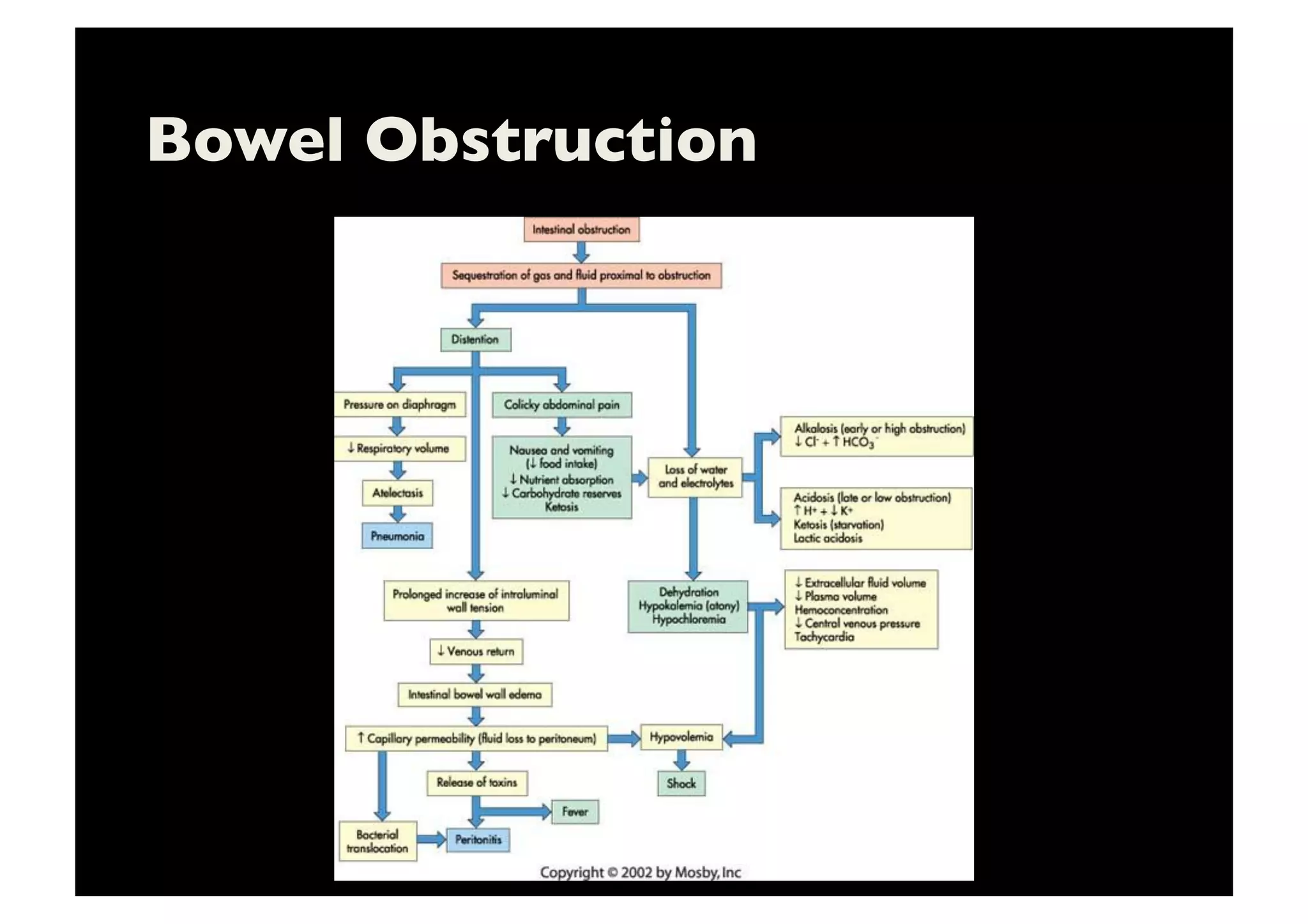 Imaging of Bowel Obstruction | PDF