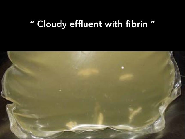 Hand Out Culture Negative Peritonitis Feb 2018 Baxter Scientia