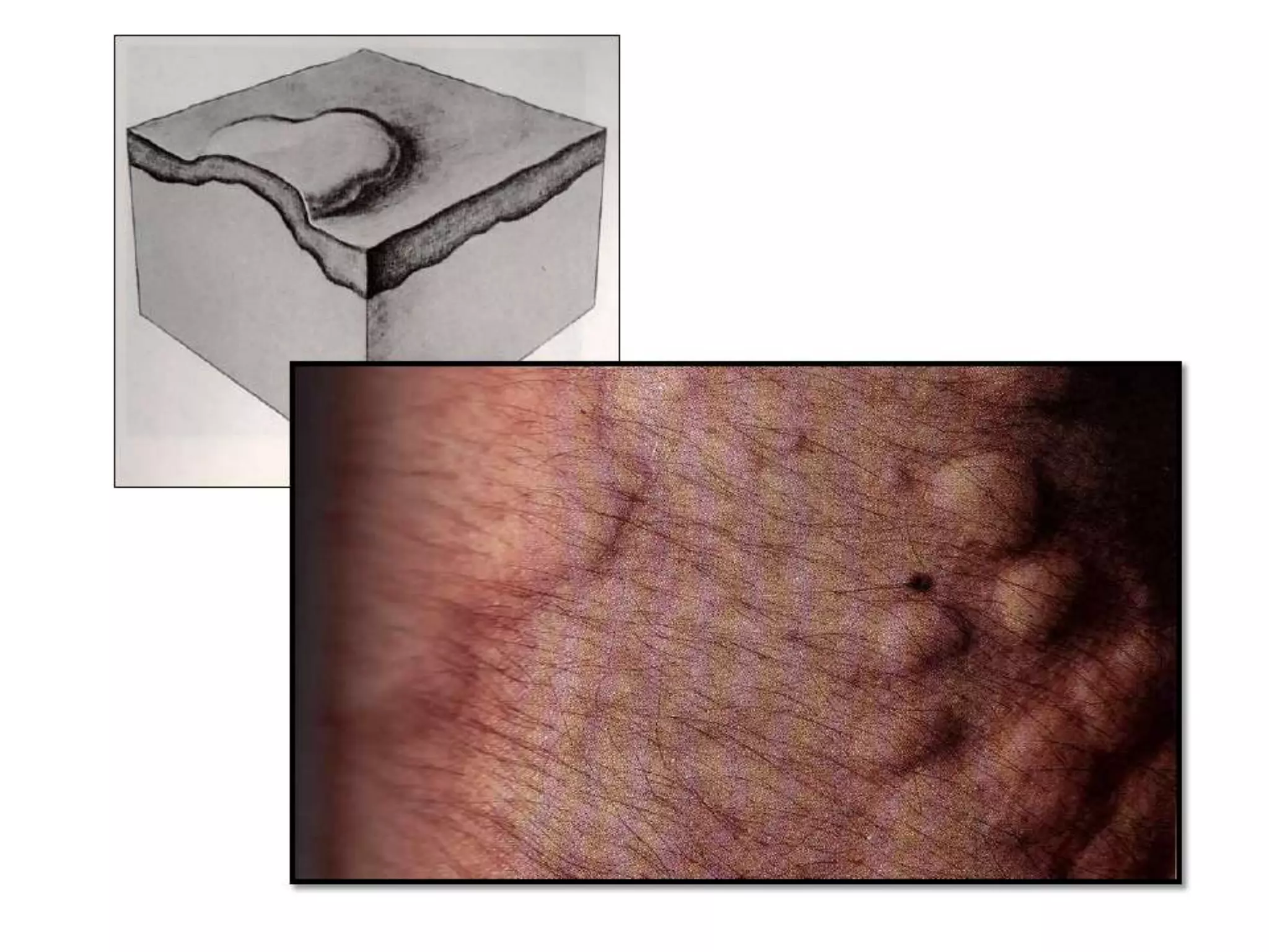 Handout morfologi dan terminologi penyakit kulit(1) | PPTX