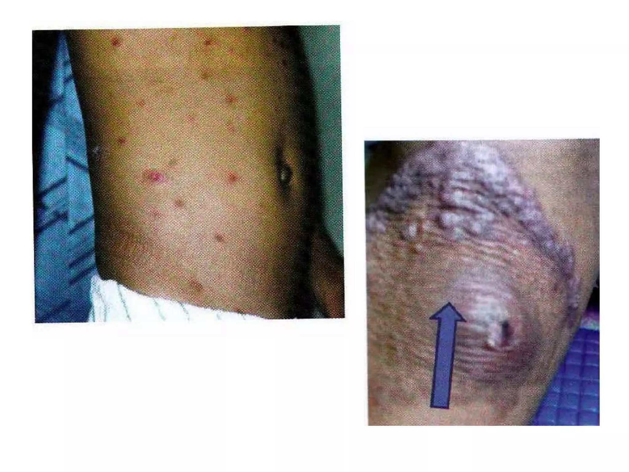 Handout morfologi dan terminologi penyakit kulit(1) | PPTX