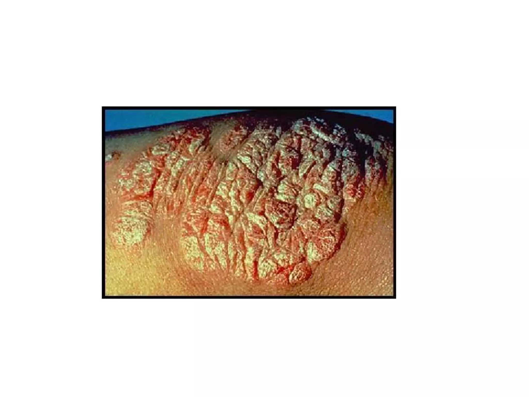 Handout morfologi dan terminologi penyakit kulit(1) | PPTX