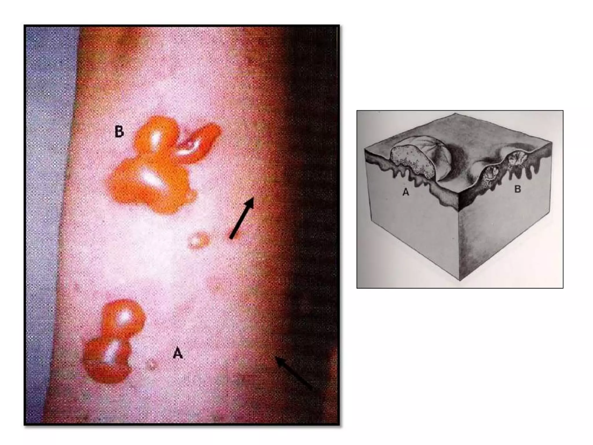 Handout morfologi dan terminologi penyakit kulit(1) | PPTX