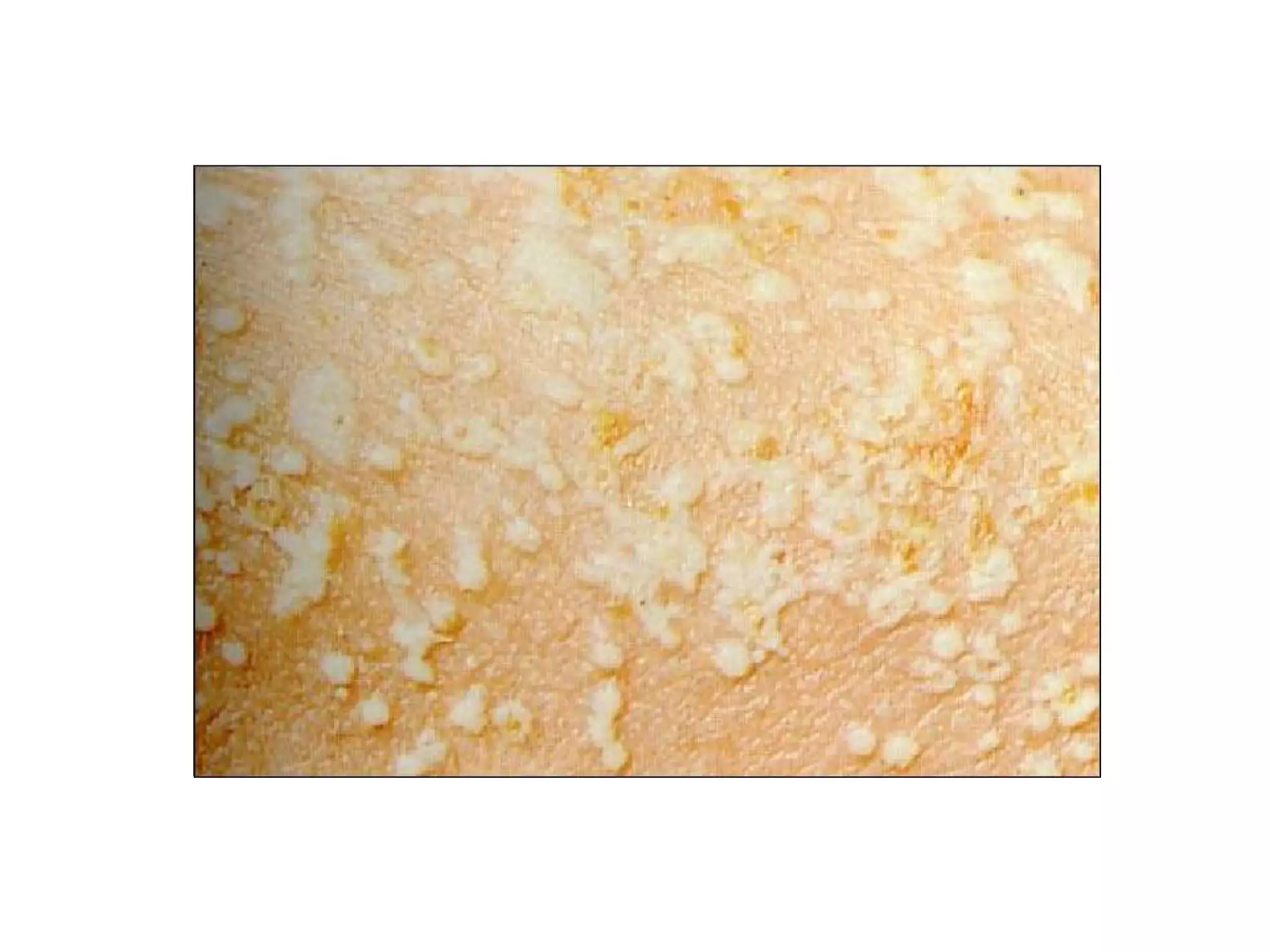 Handout morfologi dan terminologi penyakit kulit(1) | PPTX