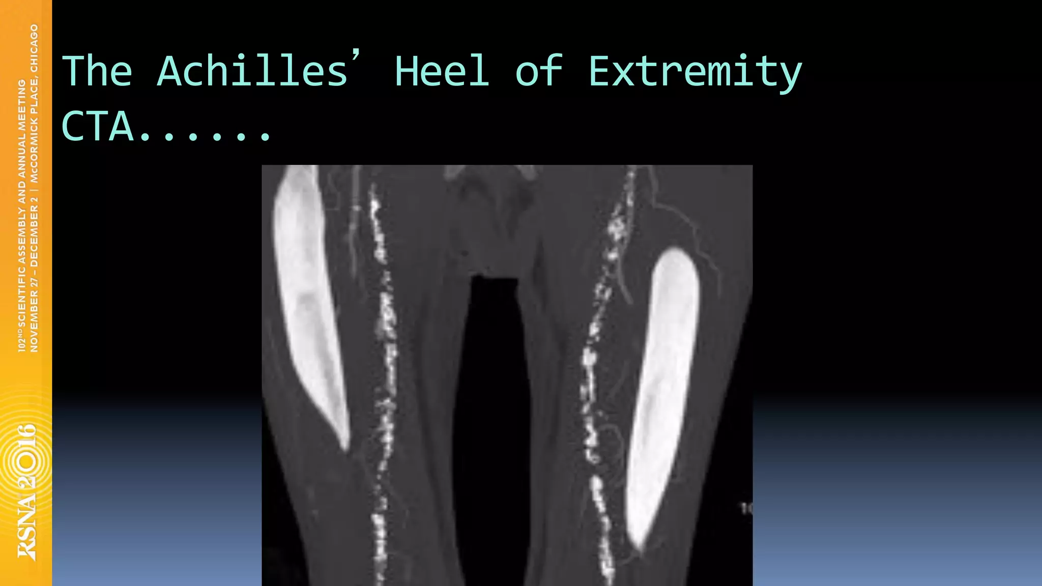 Peripheral CTA Imaging | PDF