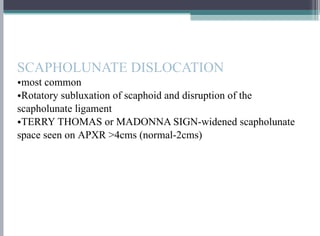 Hand pathology | PDF