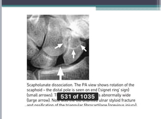 Hand pathology | PDF