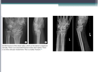 Hand pathology | PDF