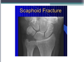 Hand pathology | PDF