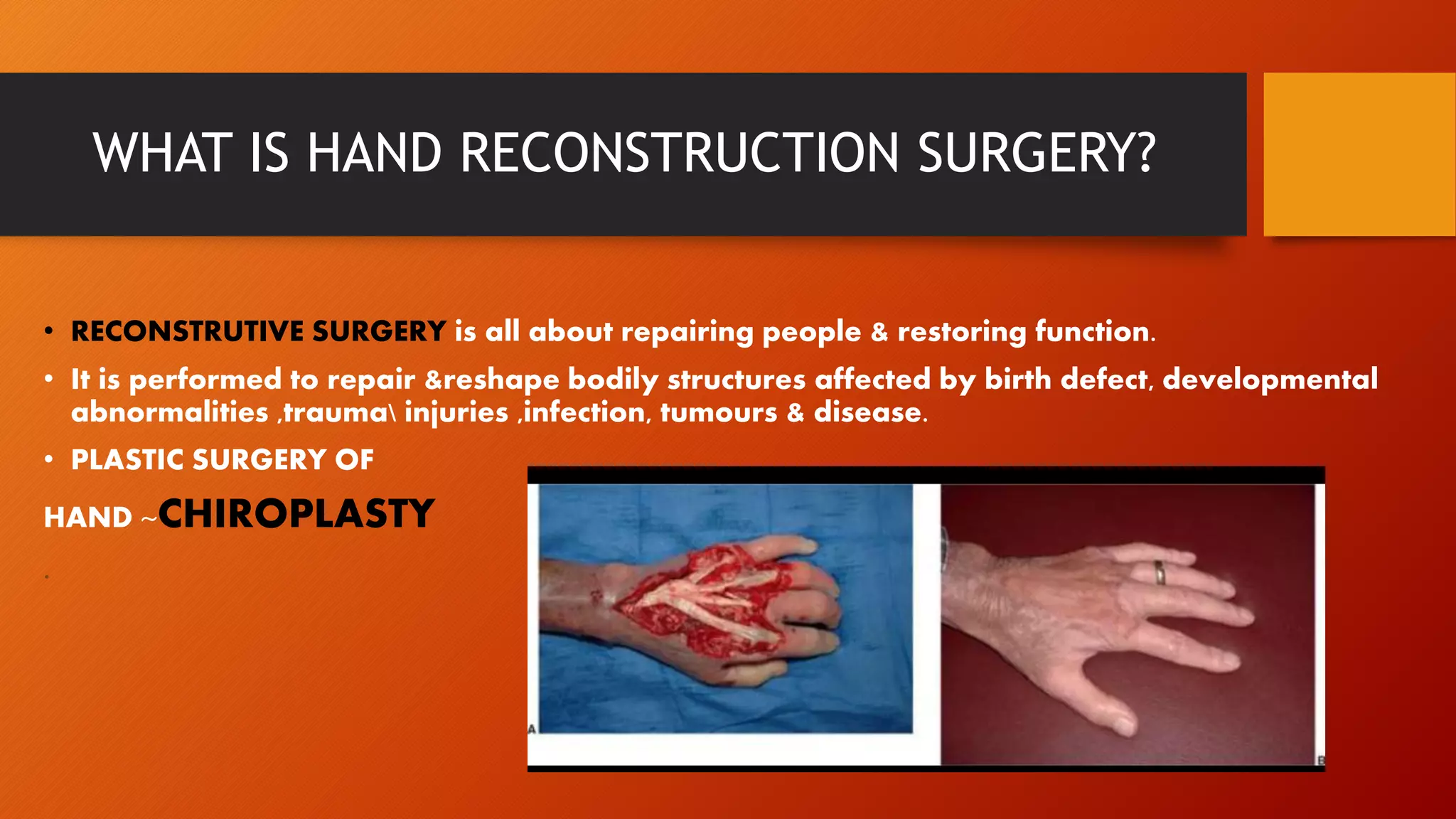 Hand reconstruction surgery & pt managment by sk | PPTX