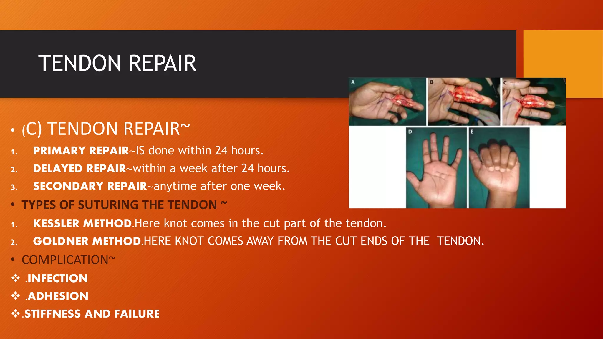 Hand reconstruction surgery & pt managment by sk | PPTX