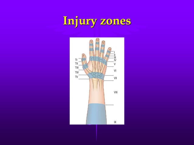 Extensor tendons injury repair and rehabilitation | PPTX