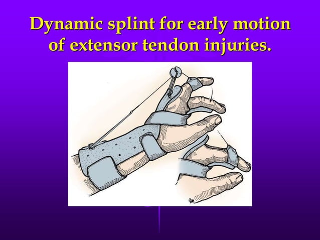 Extensor tendons injury repair and rehabilitation | PPTX