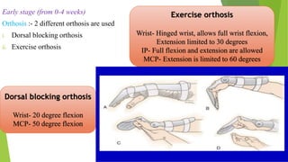 Hand rehabilitation following flexor tendon injuries | PPTX