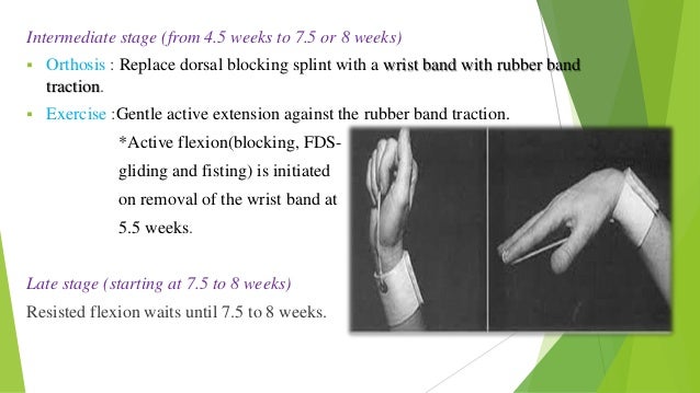 Hand rehabilitation following flexor tendon injuries