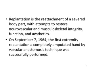 Hand Replantation.pptx
