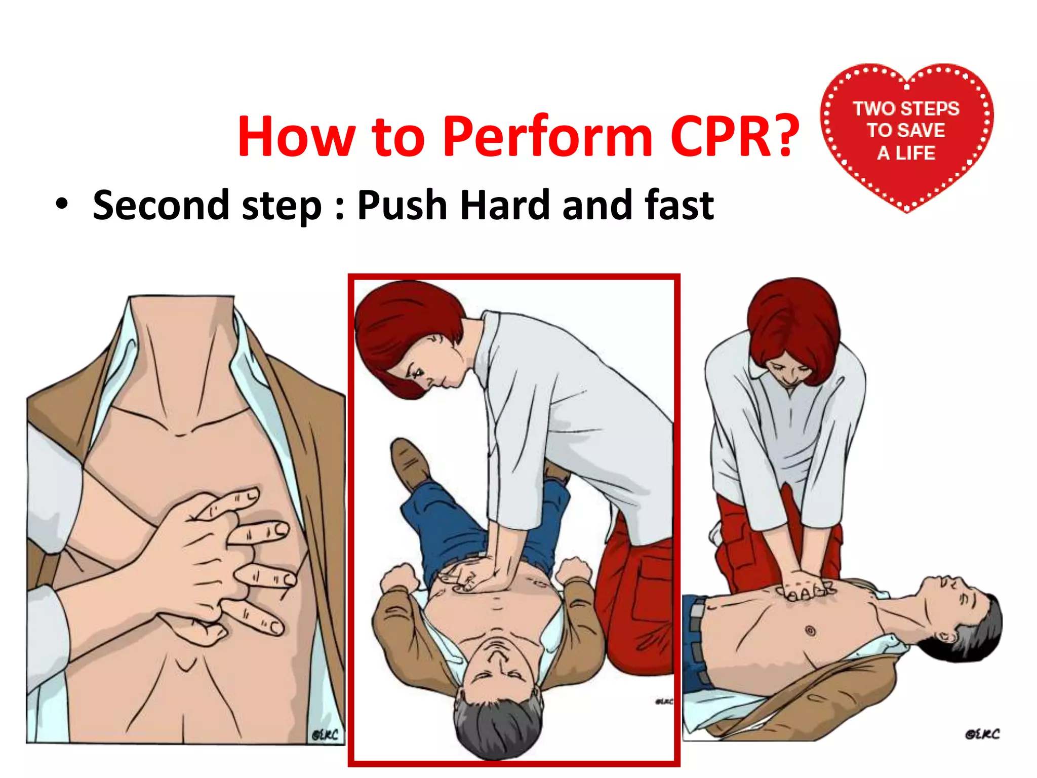 Hands only CPR | PPT