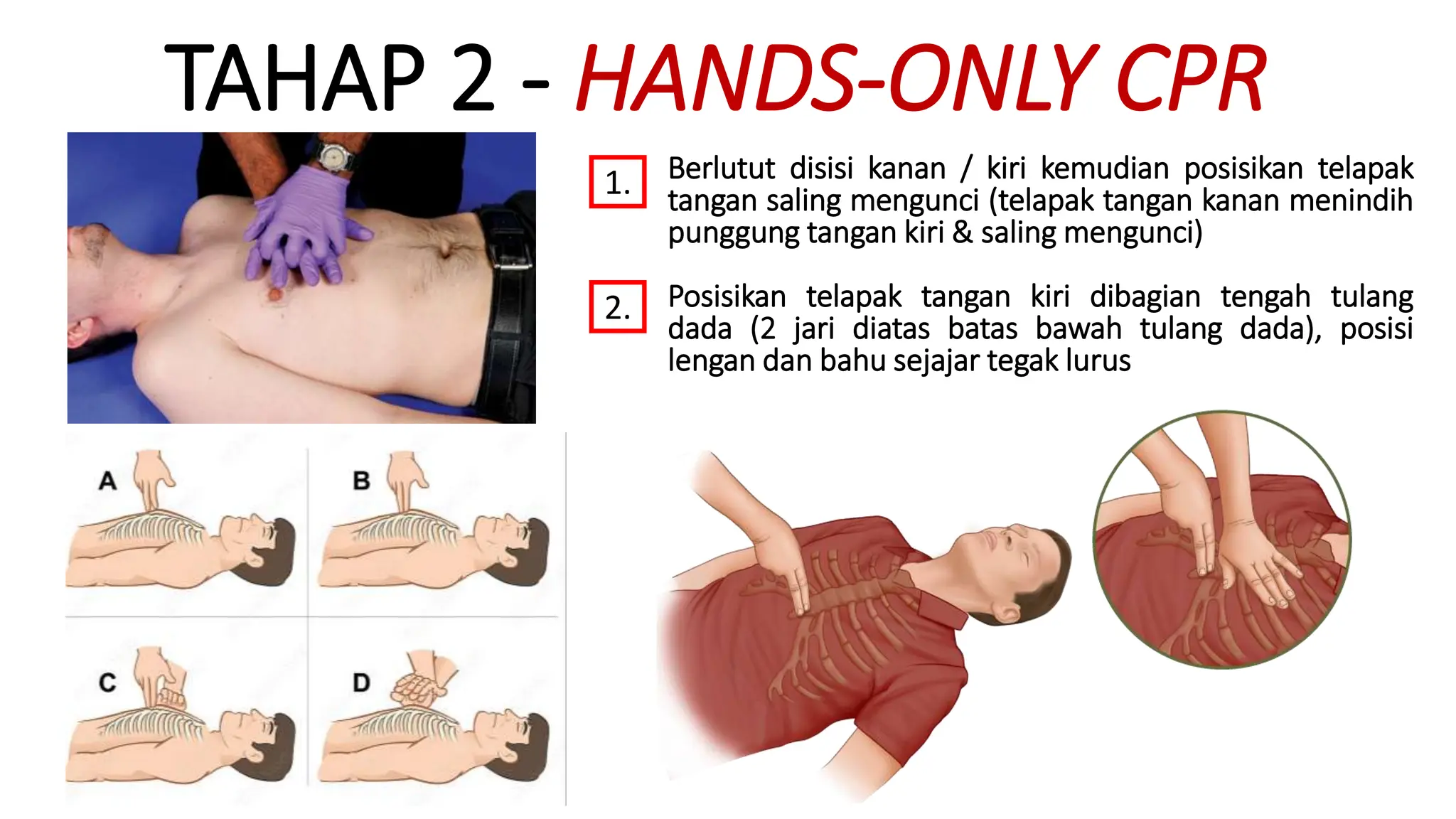 HANDS-ONLY CPR (Out of Hospital Cardiac Arrest).pptx