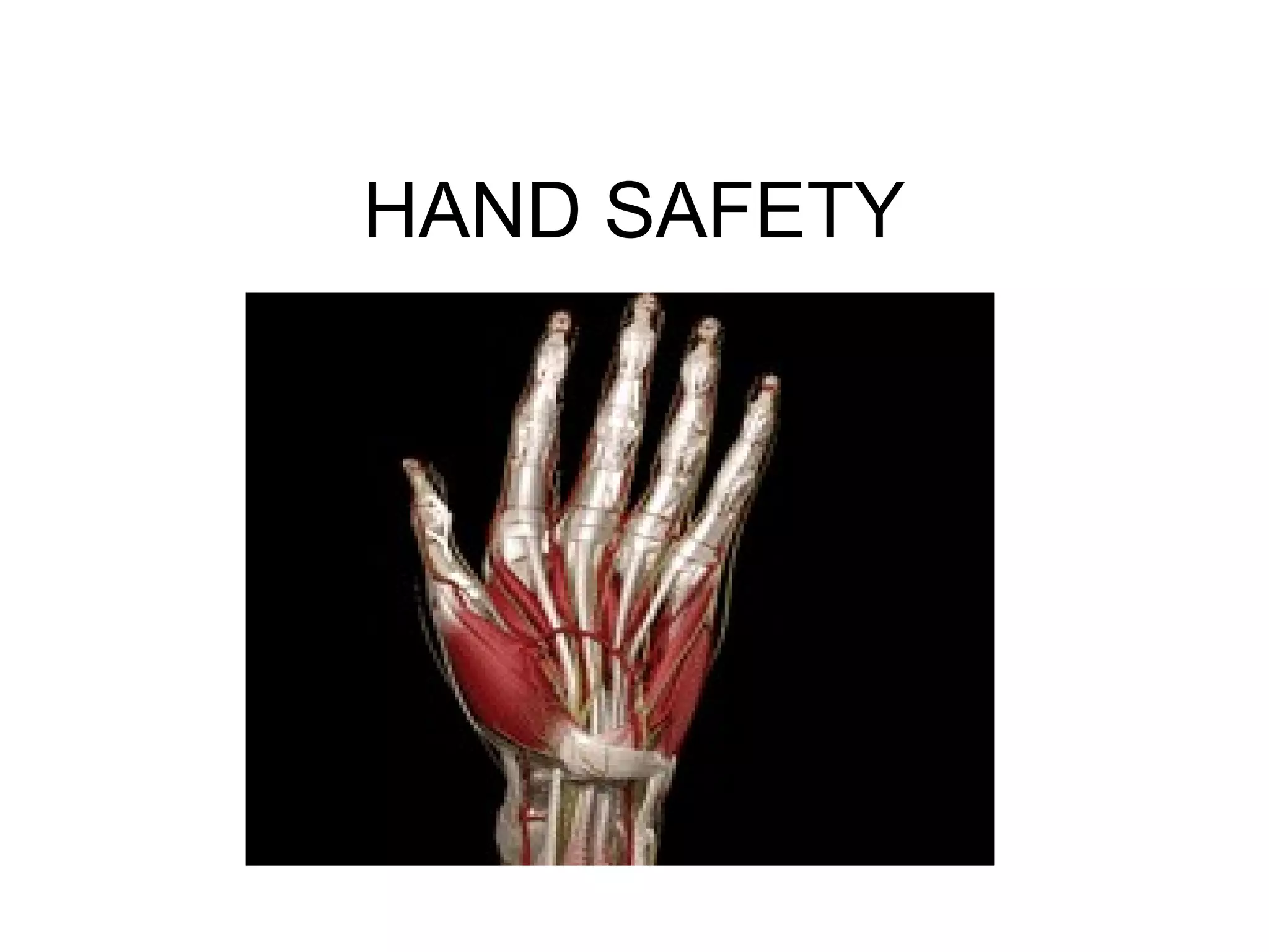 Hand safety | PPT