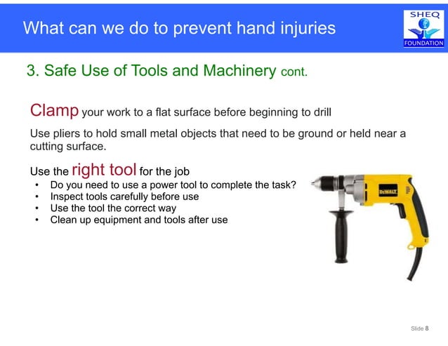 Hand safety | PDF | Injuries | Diseases and Conditions