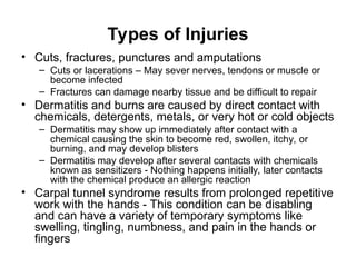 Importance of hand safety Safety ur hand | PPT