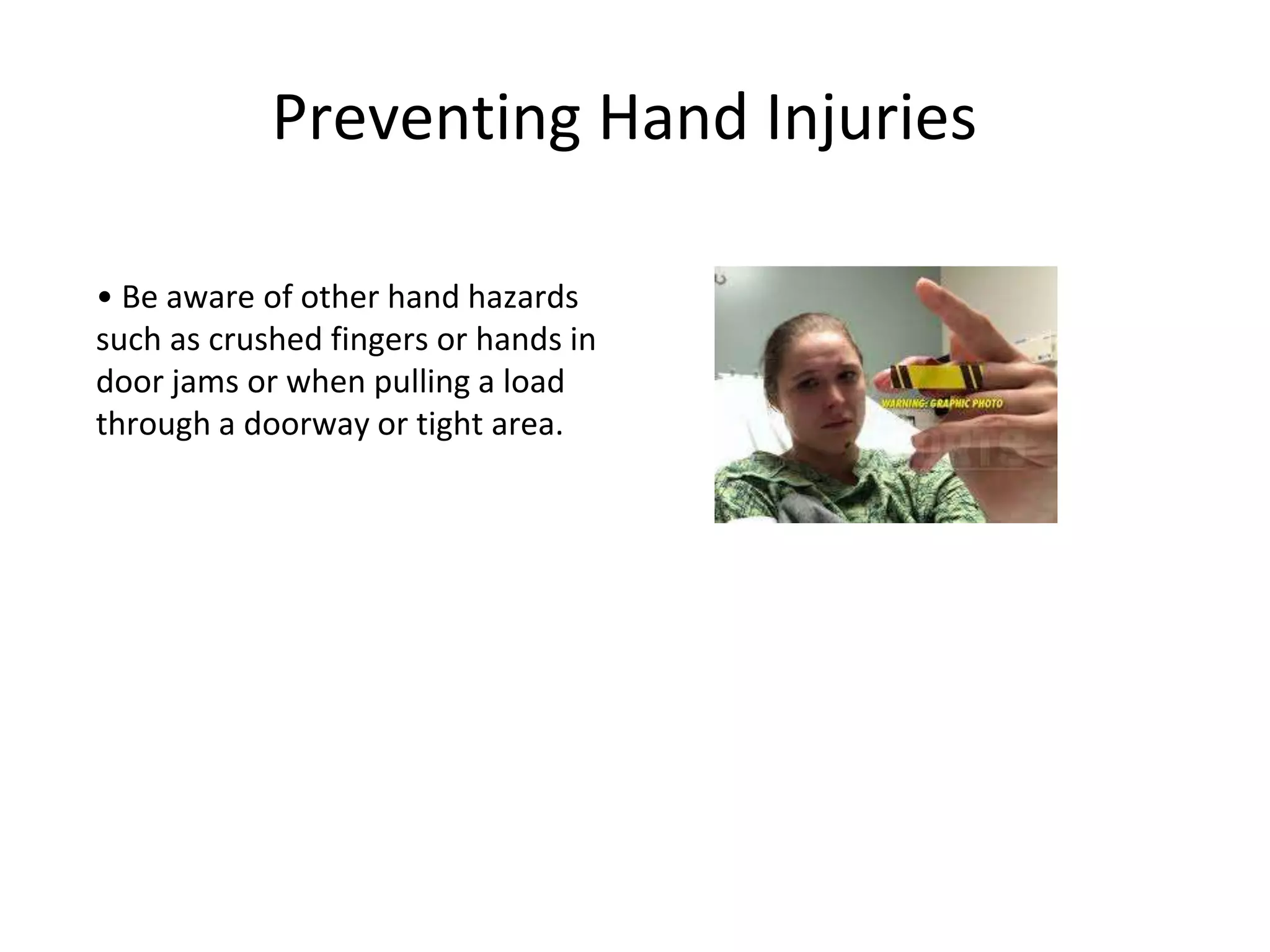 Hand Safety 2020 | PPTX