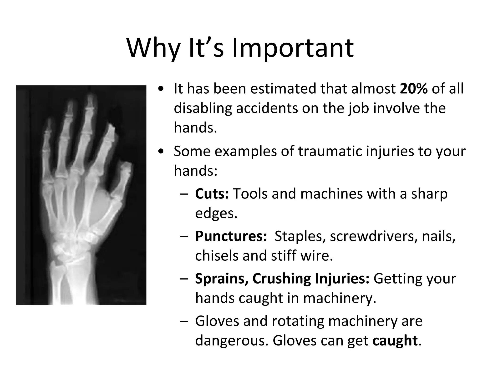 Hand Safety 2020 | PPTX