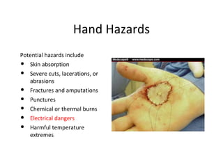 Hand Safety 2020 | PPT
