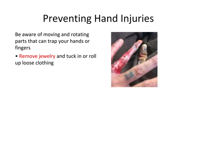 Hand safety 2020 | PPTX