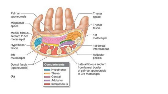 HAND SNUFF BOX (1).pptx | Death, Injury, or Military Conflict ...