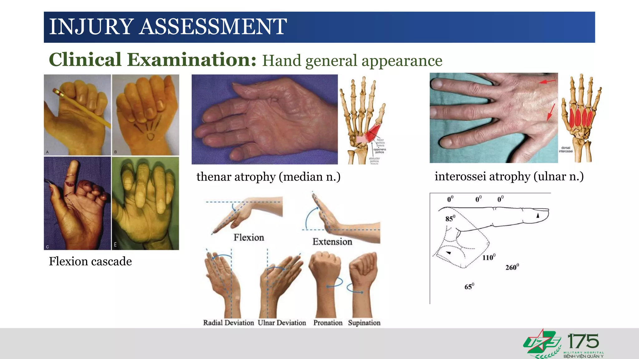 Hand Soft Tissue Injuries | PPT