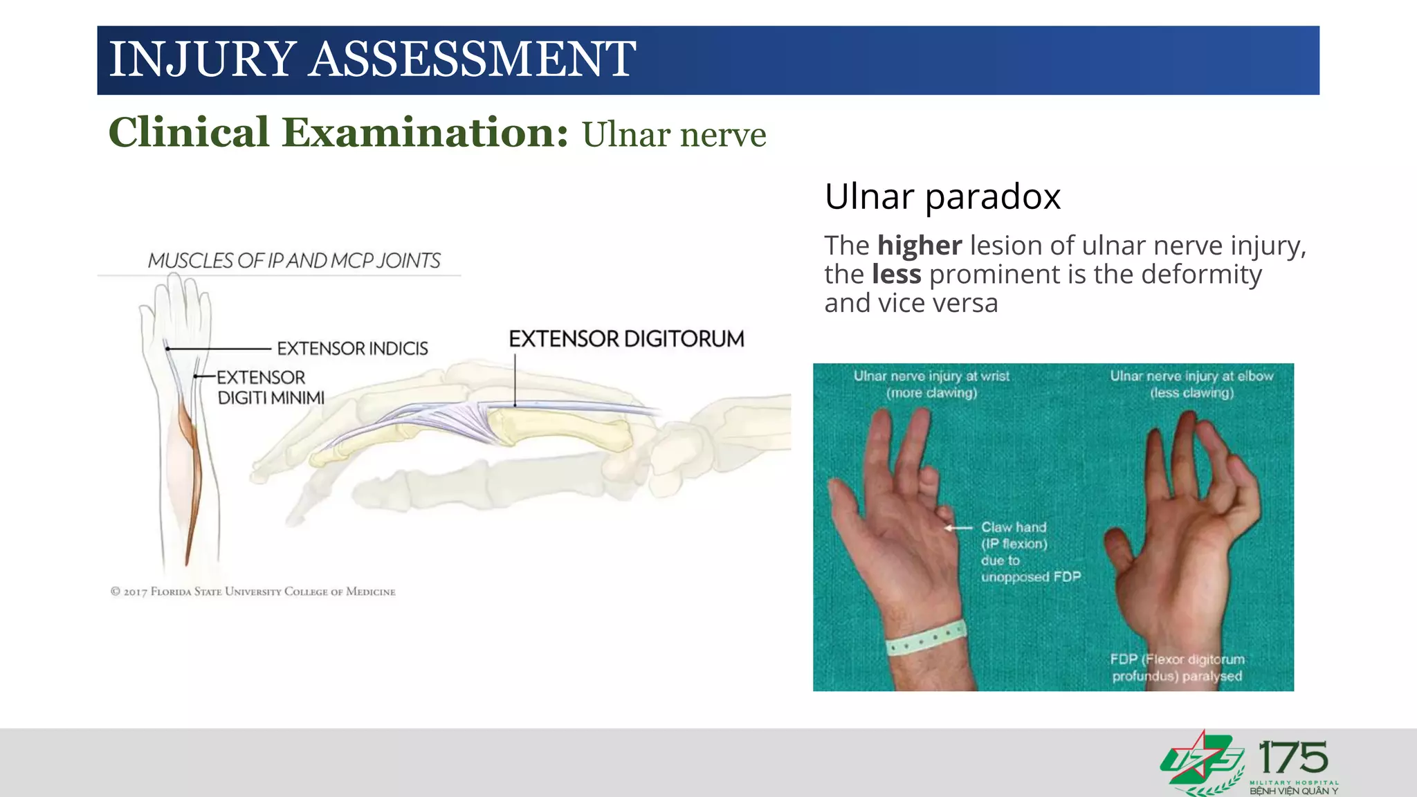 Hand Soft Tissue Injuries | PPT