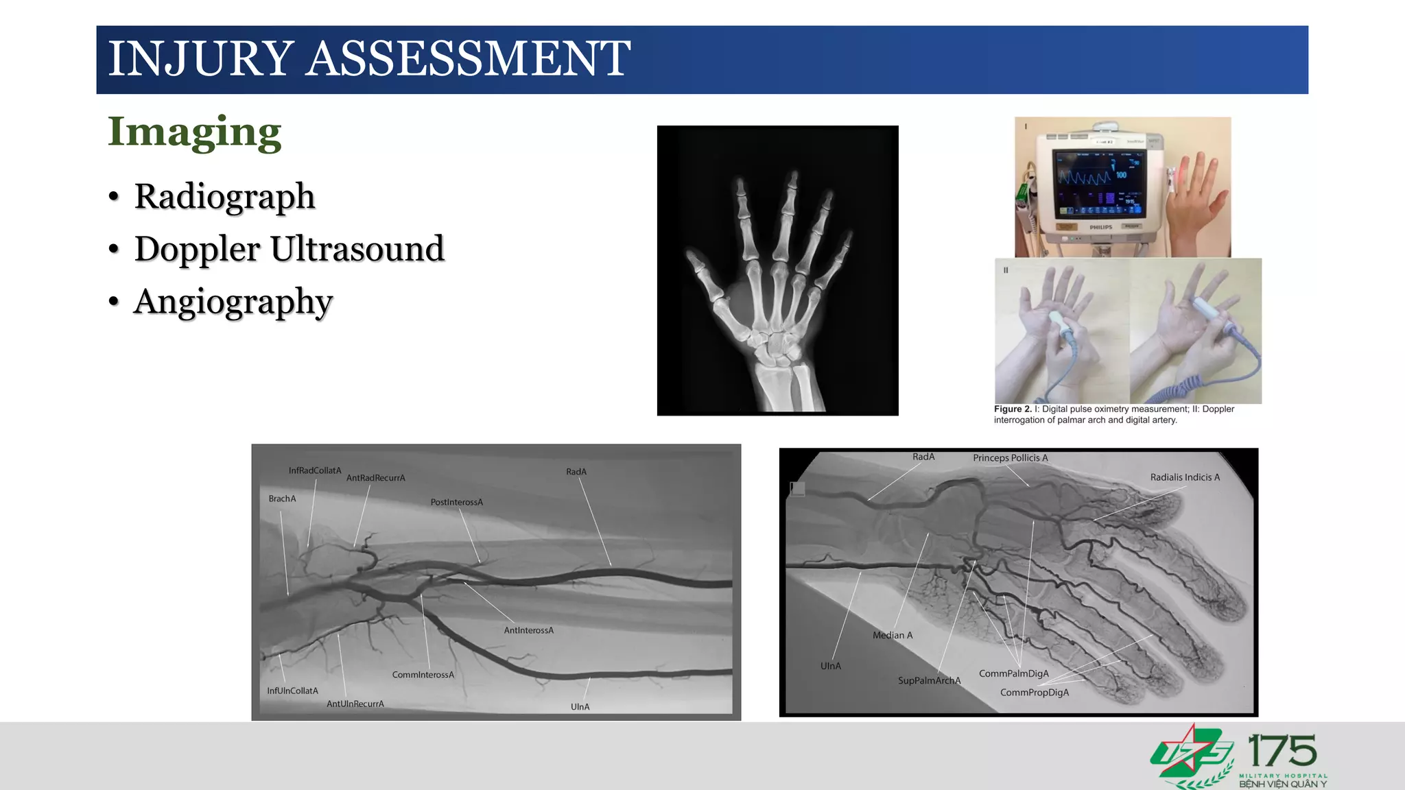 Hand Soft Tissue Injuries | PPT