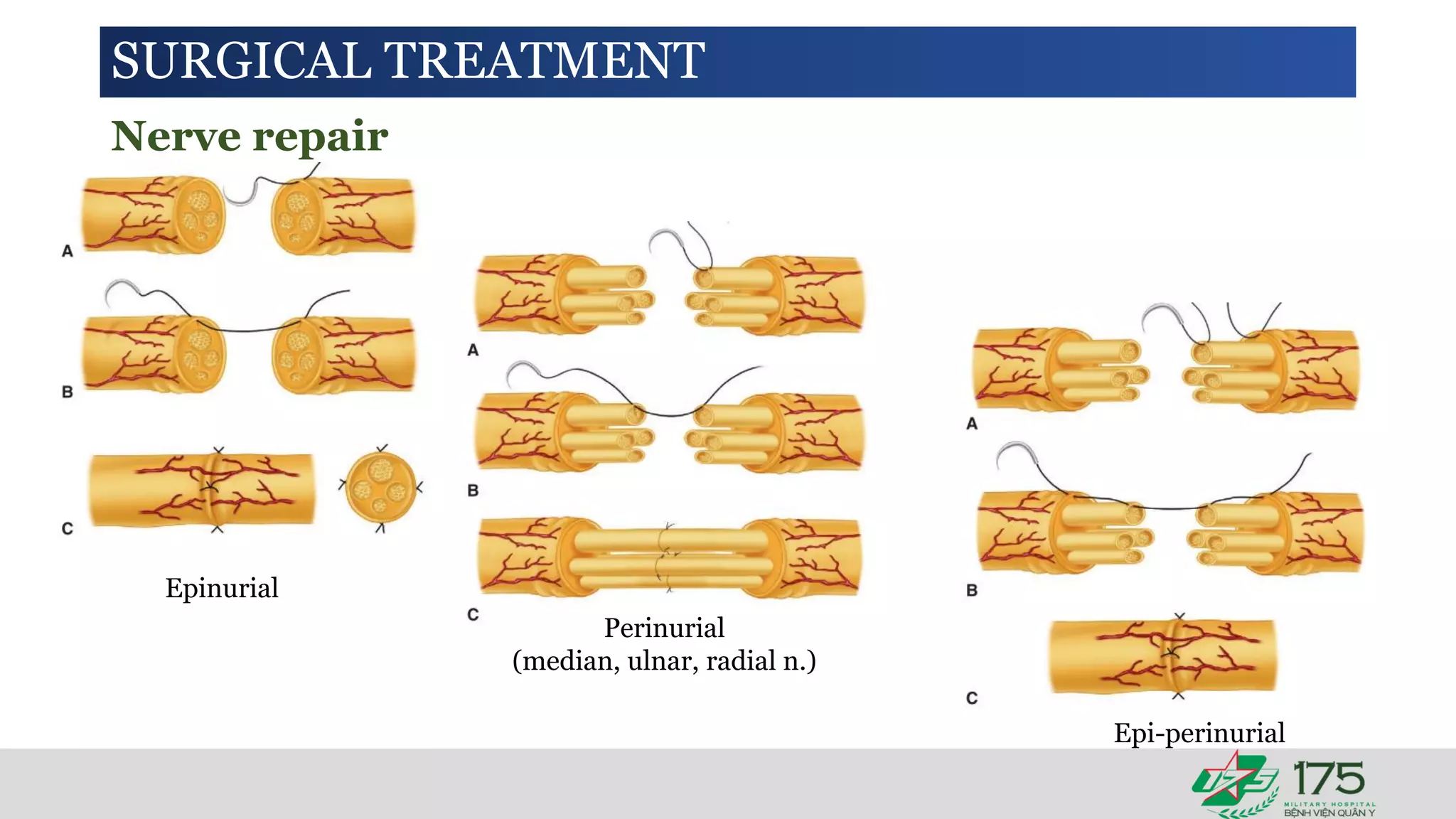 Hand Soft Tissue Injuries | PPT