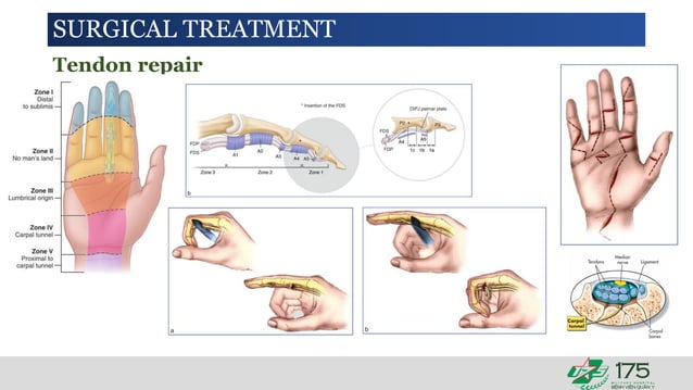 Hand Soft Tissue Injuries | PPT