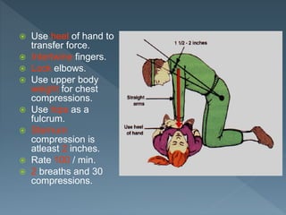 Hands on CPR. | PPT