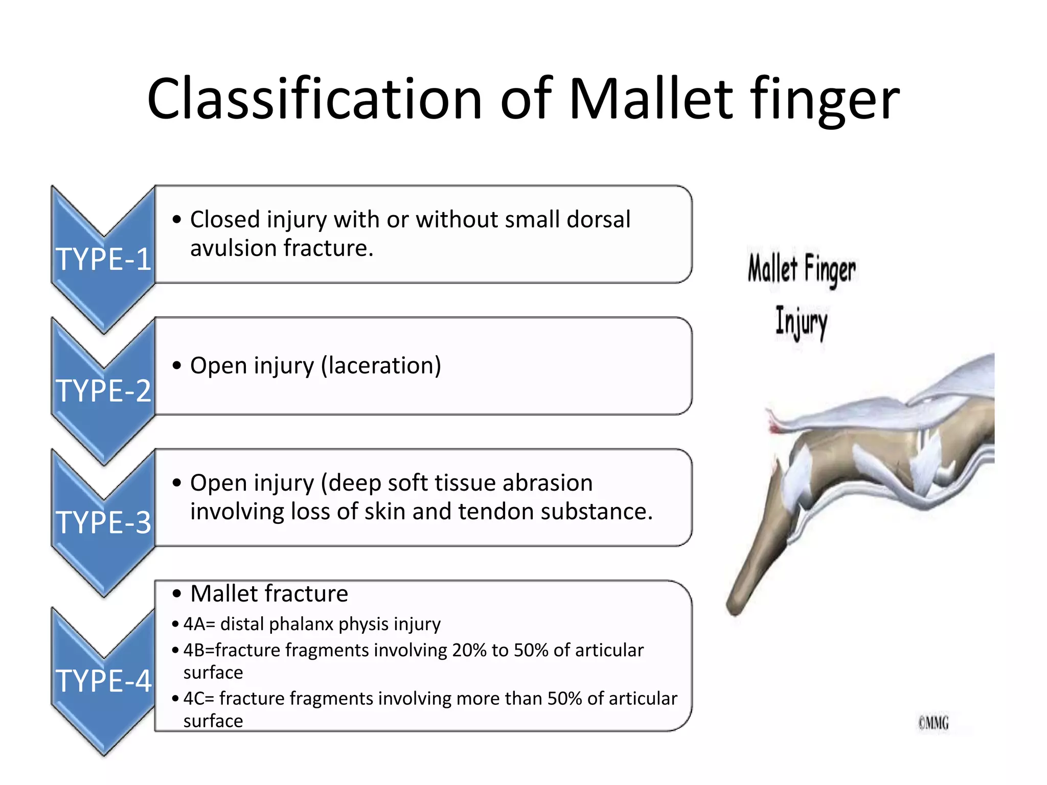 Hand splinting in common orthopedic & neurological condition 1 | PPTX