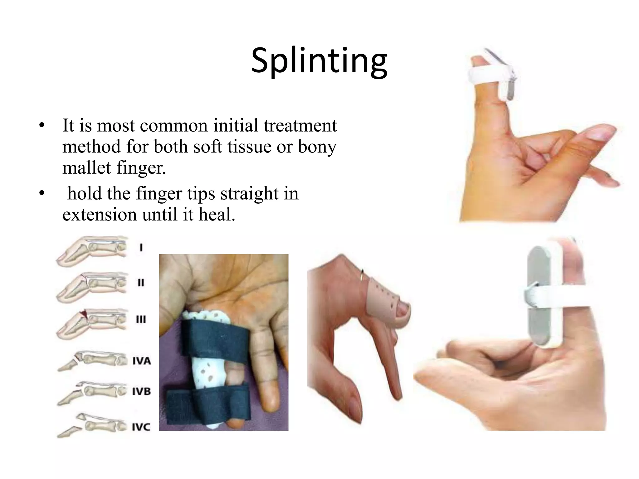 Hand splinting in common orthopedic & neurological condition 1 | PPTX